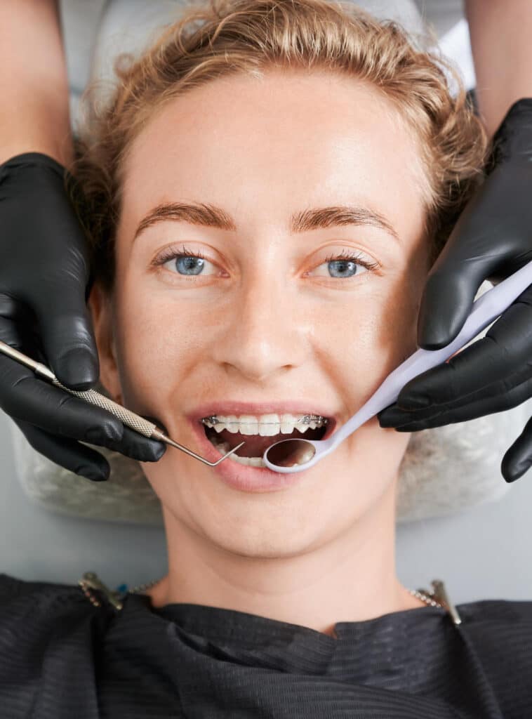 Braces in Philadelphia: Expert Care for a Perfect Smile